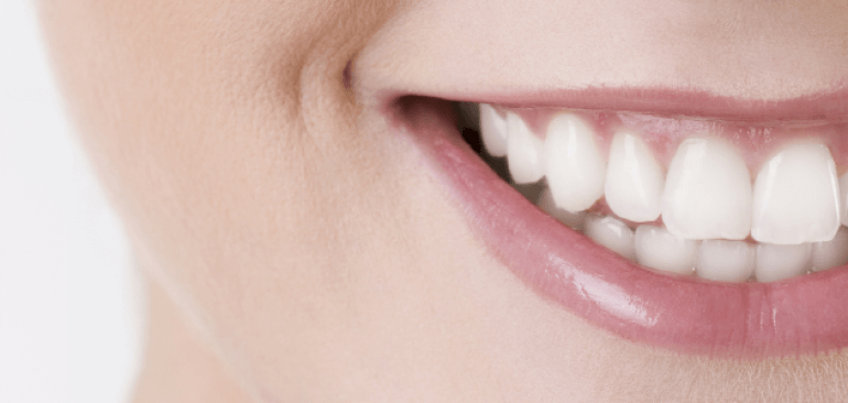 Teeth Straightening Costs And Information The Dental Guide