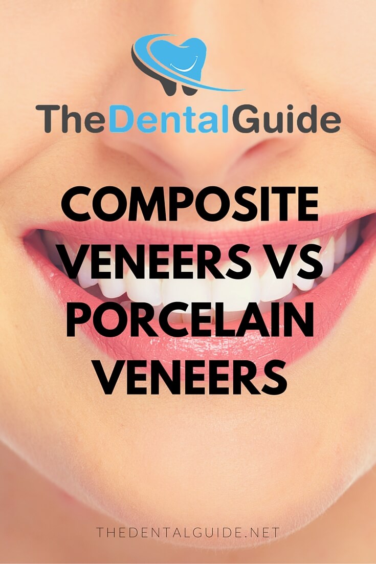Composite Veneers vs Porcelain Veneers - The Dental Guide Composite Veneers vs Porcelain Veneers - The Dental Guide